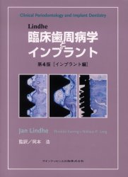Lindhe臨床歯周病学とインプラント インプラント編 （第4版） Jan Lindhe／編著 Thorkild Karring／編著 ...