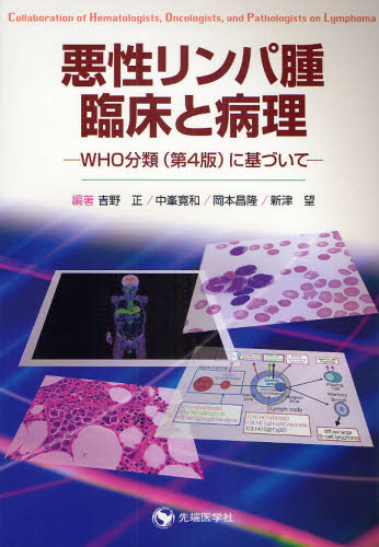 悪性リンパ腫臨床と病理 WHO分類（第4版）に基づいて 吉野正／編著 中峯寛和／編著 岡本昌隆／編著 新津望／編著 癌、腫瘍一般の本 - 最 ...